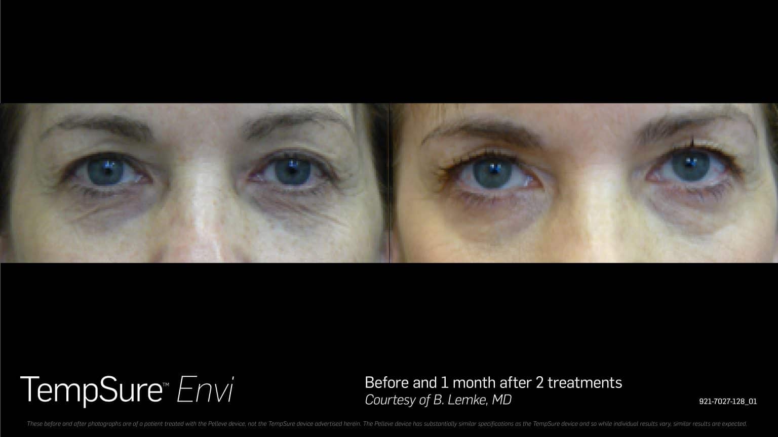 Icare Optical Services - iCare Optical